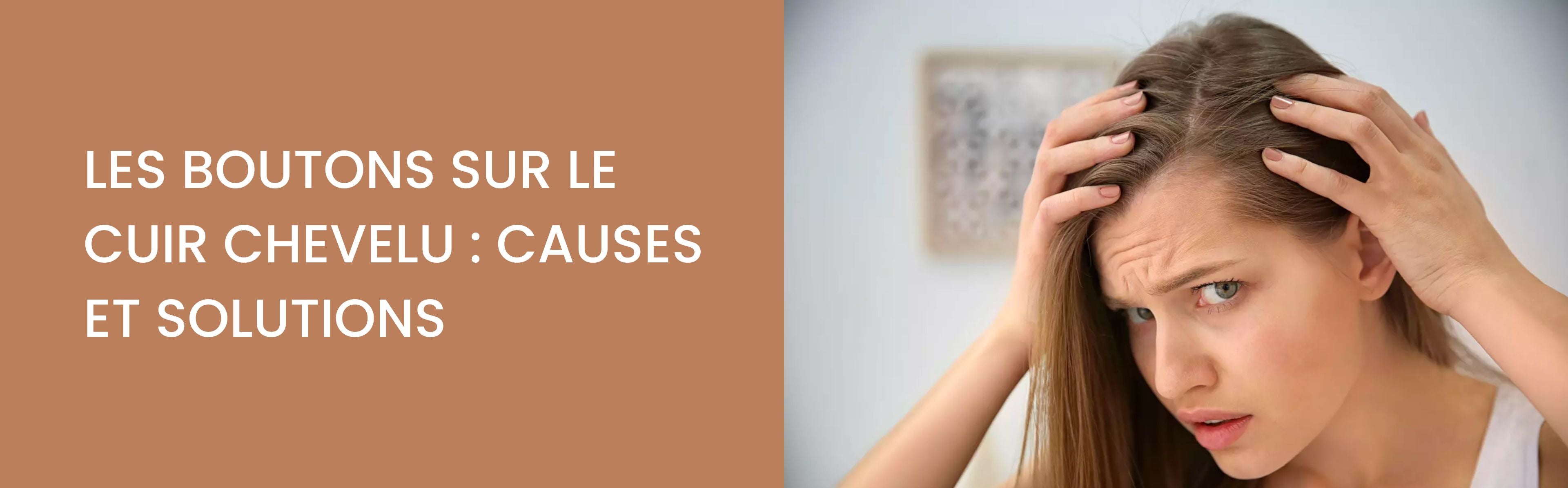 Les Boutons sur le Cuir Chevelu : Comprendre et Traiter